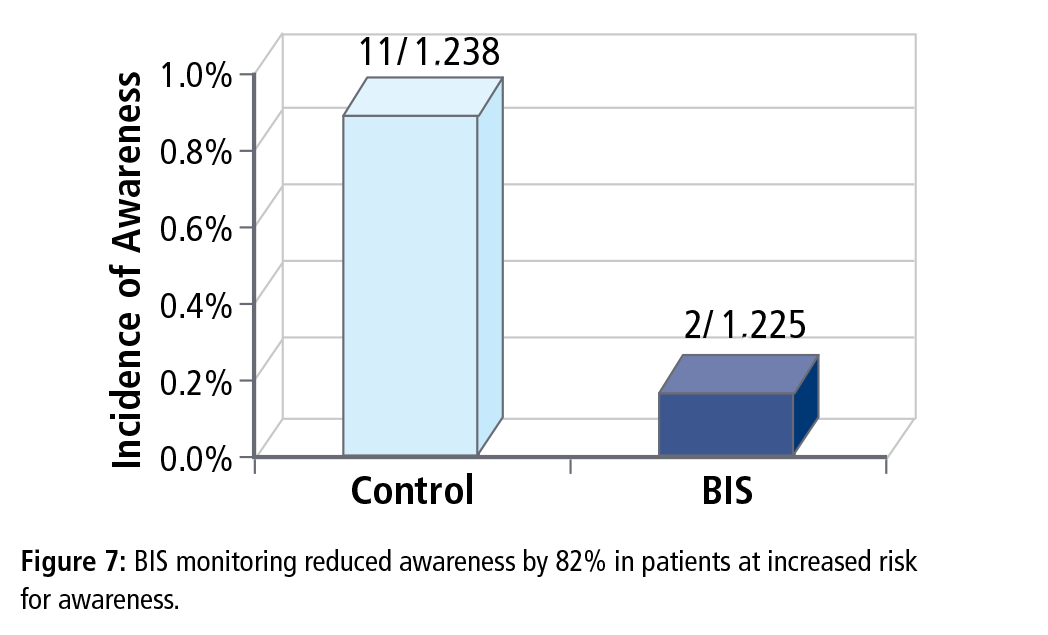 Índice biespectral (BIS): Seguridad para el paciente y ayuda para el ...